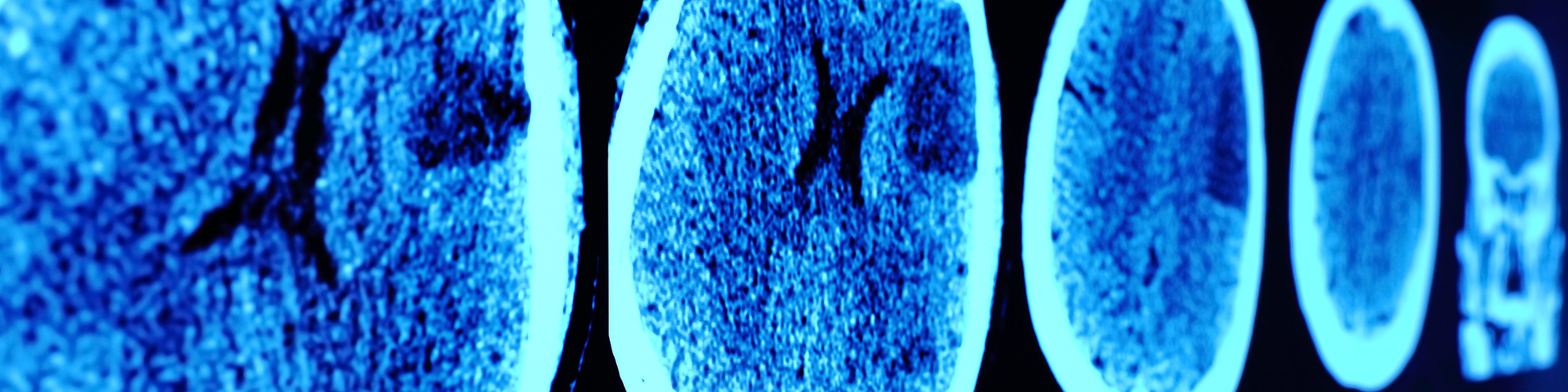 Biospecimen Clinical Research Unit - Children's Hospital of ...